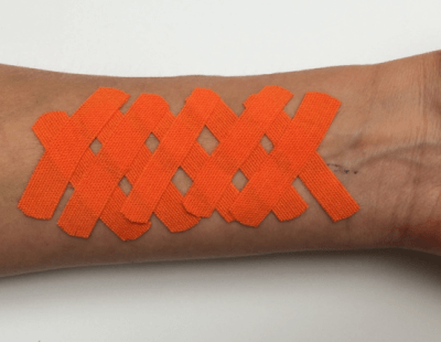 Kinesiology taping for scars - THYSOL USA