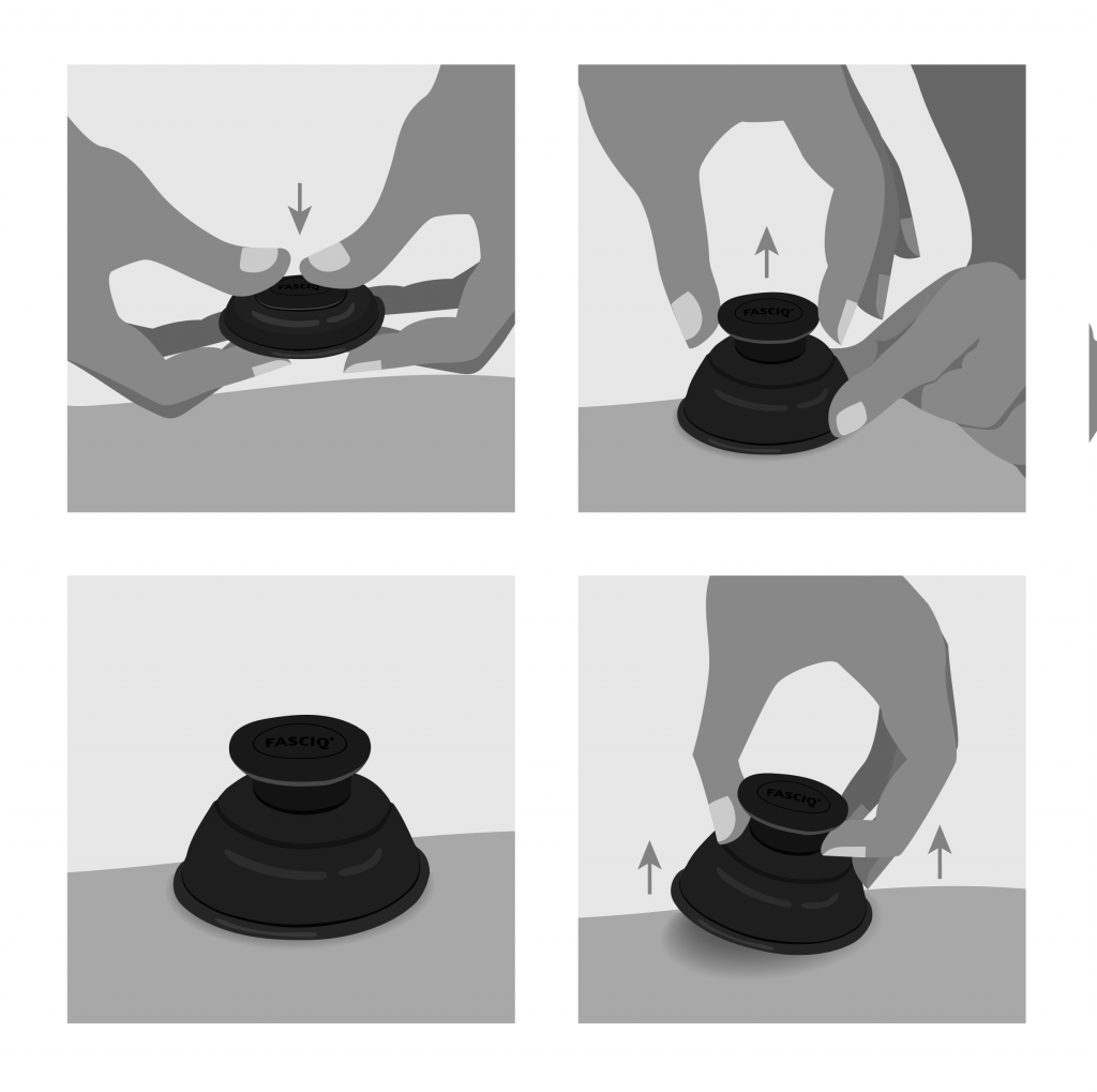 FASCIQ® Sports Cupping Set - Professional or Home Use